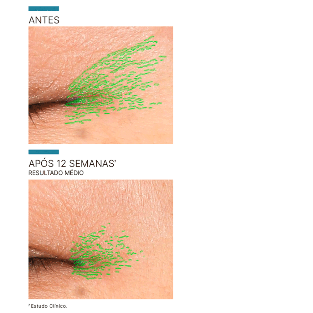 Sérum Facial Antirrugas Skinceuticals P-Tiox 30ml - Drogaria Sao Paulo