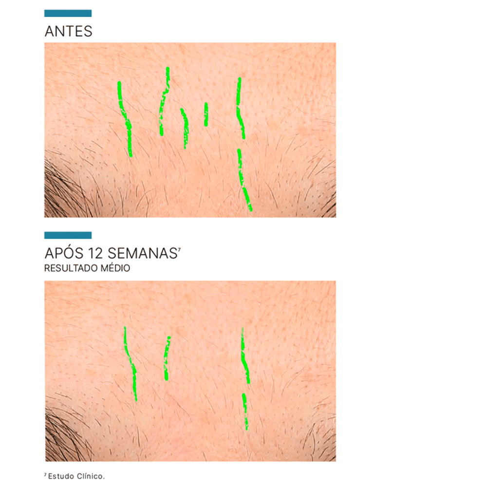 Sérum Facial Antirrugas Skinceuticals P-Tiox 30ml - Drogaria Sao Paulo